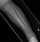 The Quest for Height: Grow Taller | Increase Height | Bone Size ...