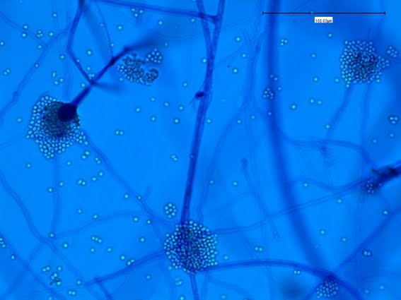 Fun With Microbiology (What's Buggin' You?): Absidia corymbifera ...
