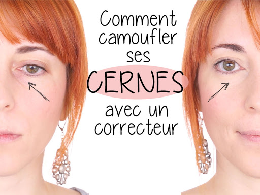 Comment lutter contre les cernes ? ~ Nos Conseils de Vie