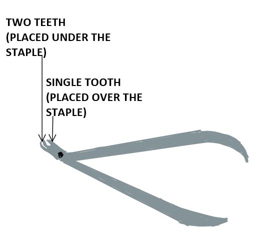 Medicowesome: Suture and Staples removal