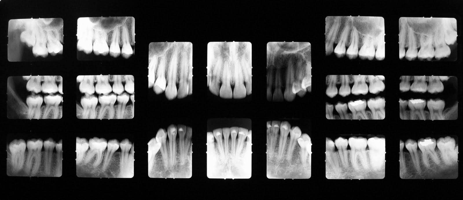 LOS RAYOS X EN LA ESTOMATOLOGIA: TECNICAS DE RADIOLOGIA