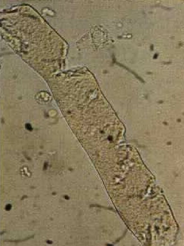 Algo de microbiología: Urocultivo:protocolo de rutina