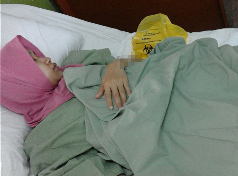 Prosedur dan Kos Pembedahan Buasir @ Hemorrhoid di Hospital Kerajaan