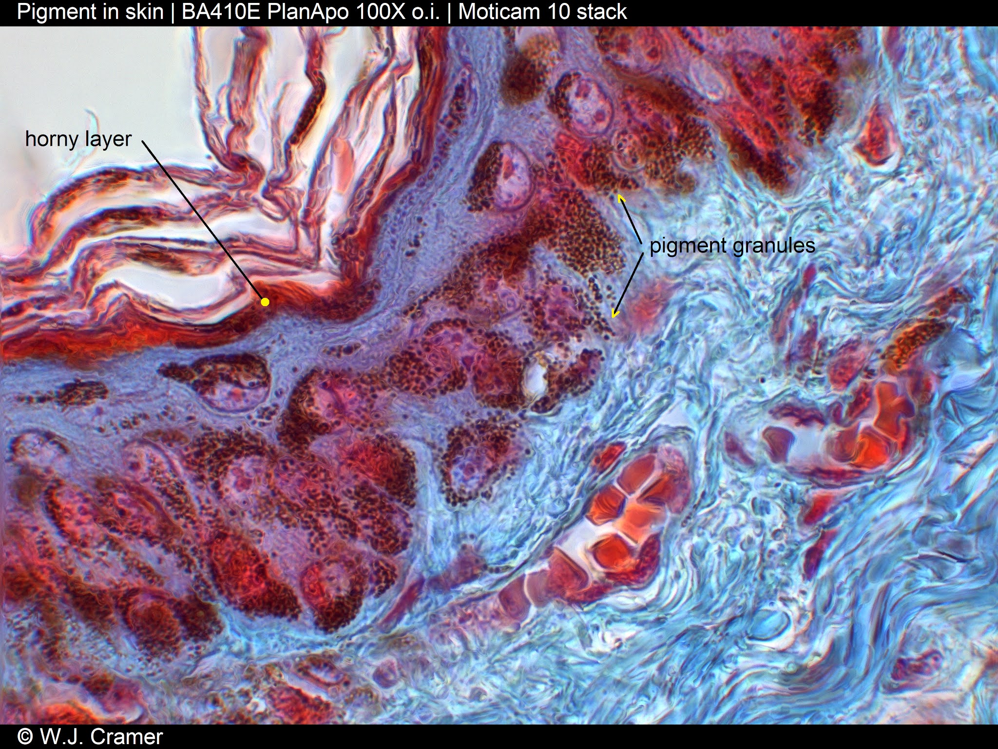 Motic Europe | Blog: Pigment protects