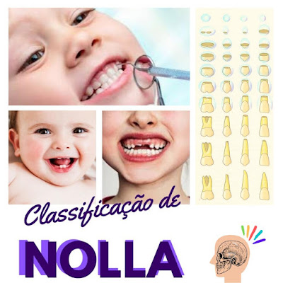 Canal da Odonto: CLASSIFICAÇÃO DE NOLLA