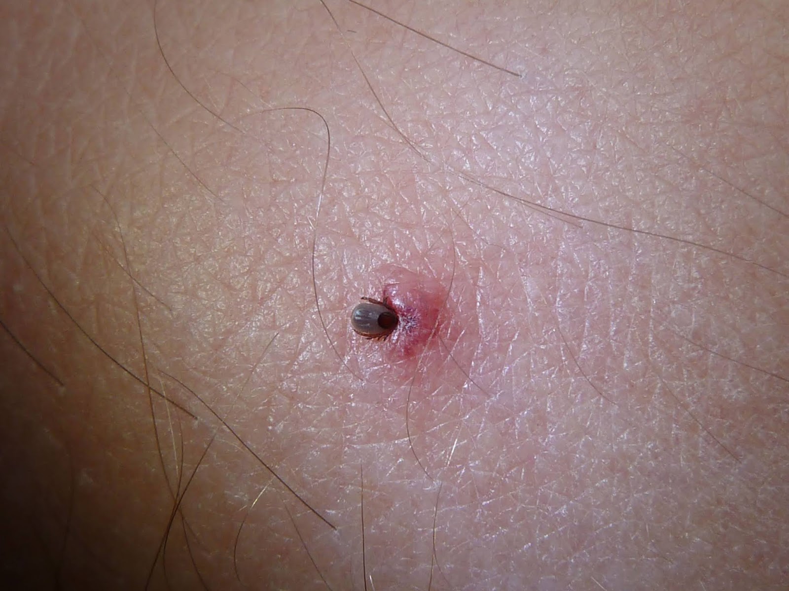 Hardlopen in de Nederlandse- en Duitse grensstreek: Wat doe je bij een ...