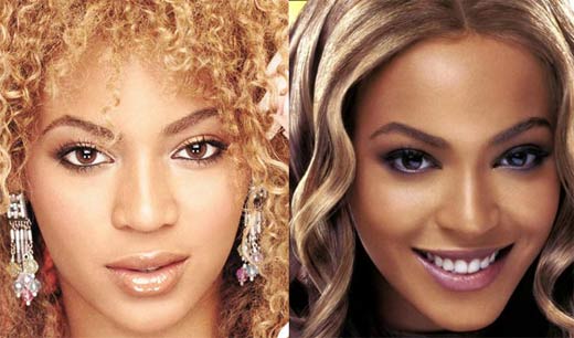 Beyonce Plastic Surgery
