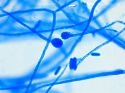 Fun With Microbiology (What's Buggin' You?): Sepedonium species