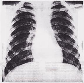 dokter-medis: Cara membaca Foto Rontgen Thorak (Chest X-Ray) Dewasa