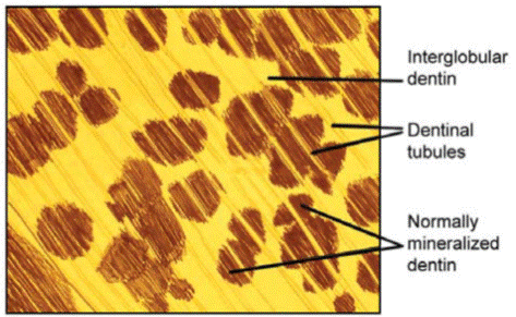 Dentin- Microscopic Structure, Properties, Types and Functions