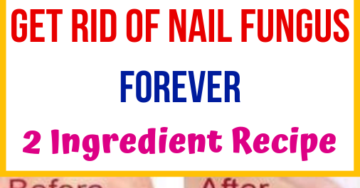 Get Rid Of Nail Fungus Forever 2 Ingredient Recipe