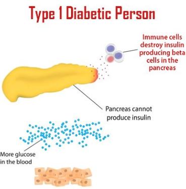 Understanding Diabetes for a better treatment