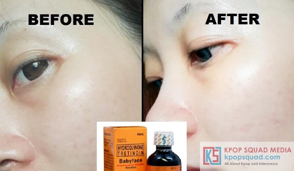 Perbedaan Toner RDL No 2 dan 3 | Kpop Squad Media | All about K-Pop and ...