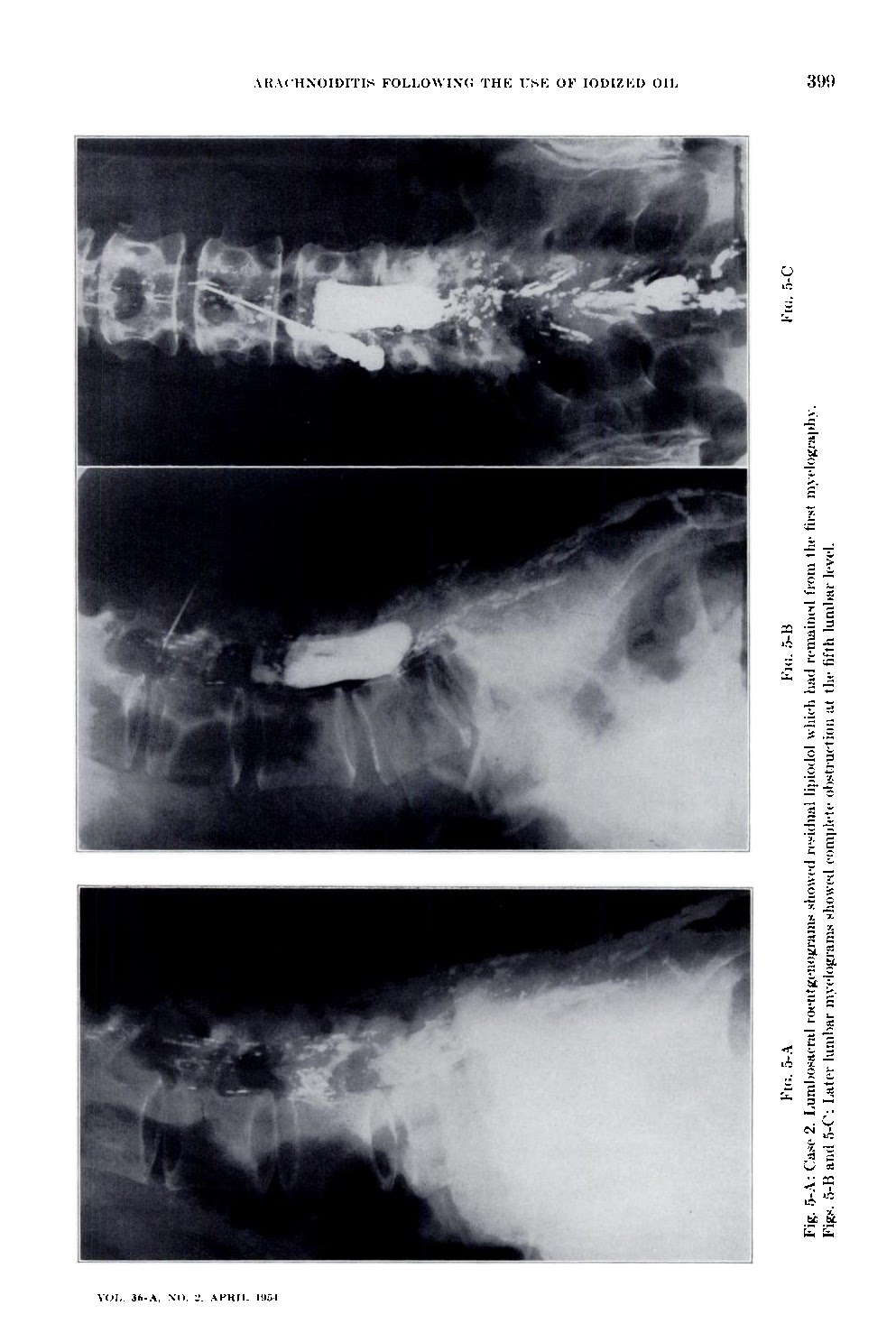 Myodil Killer: 7. Revue Patient Cases and Dog Test Results 1954