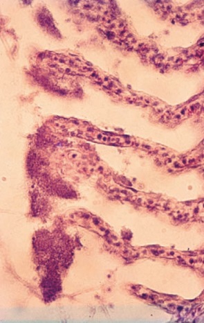 \ Columnaris Disease