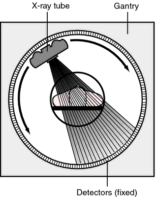 CROSS-SECTIONAL IMAGING EDUCATION HUB: GENERATIONS OF CT SCANNERS