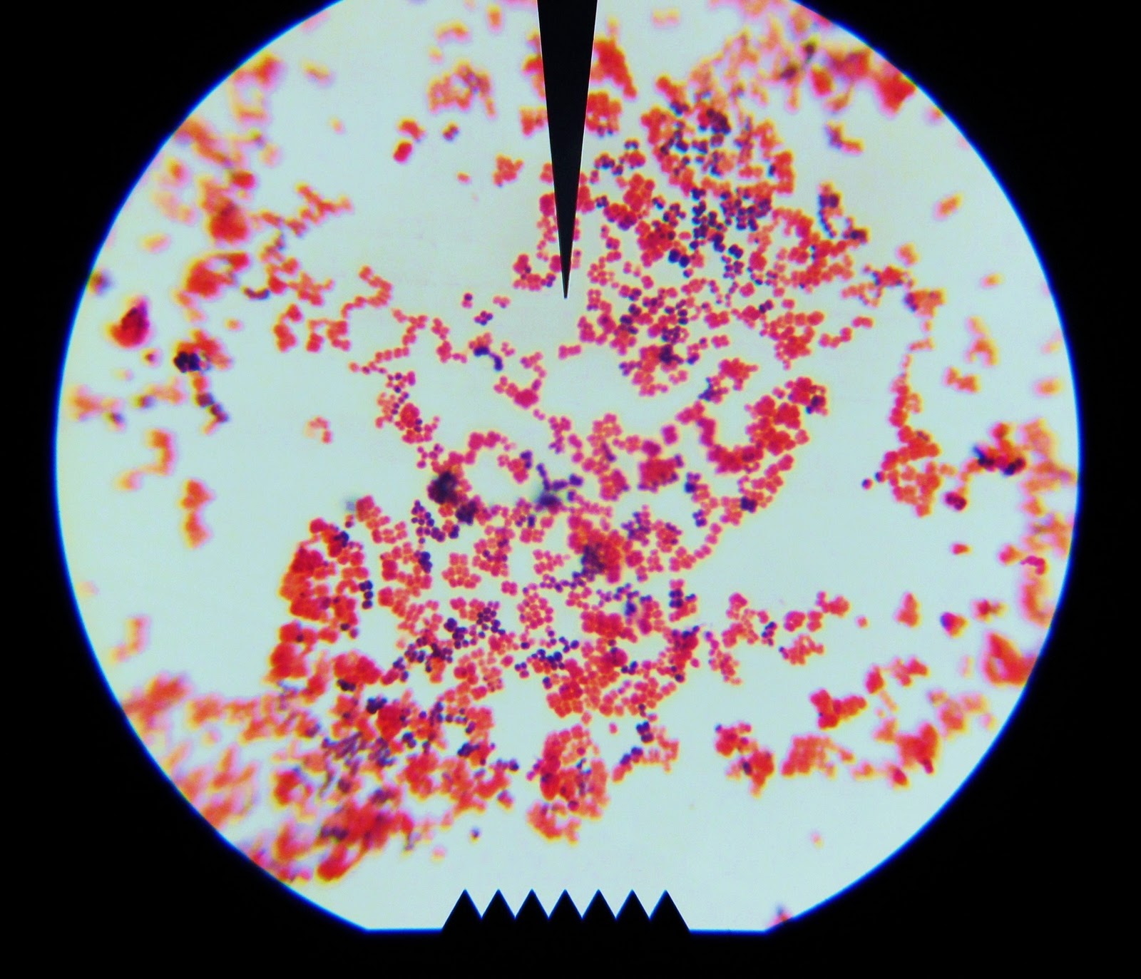 MicrobeDiscoveries: Gram Stain