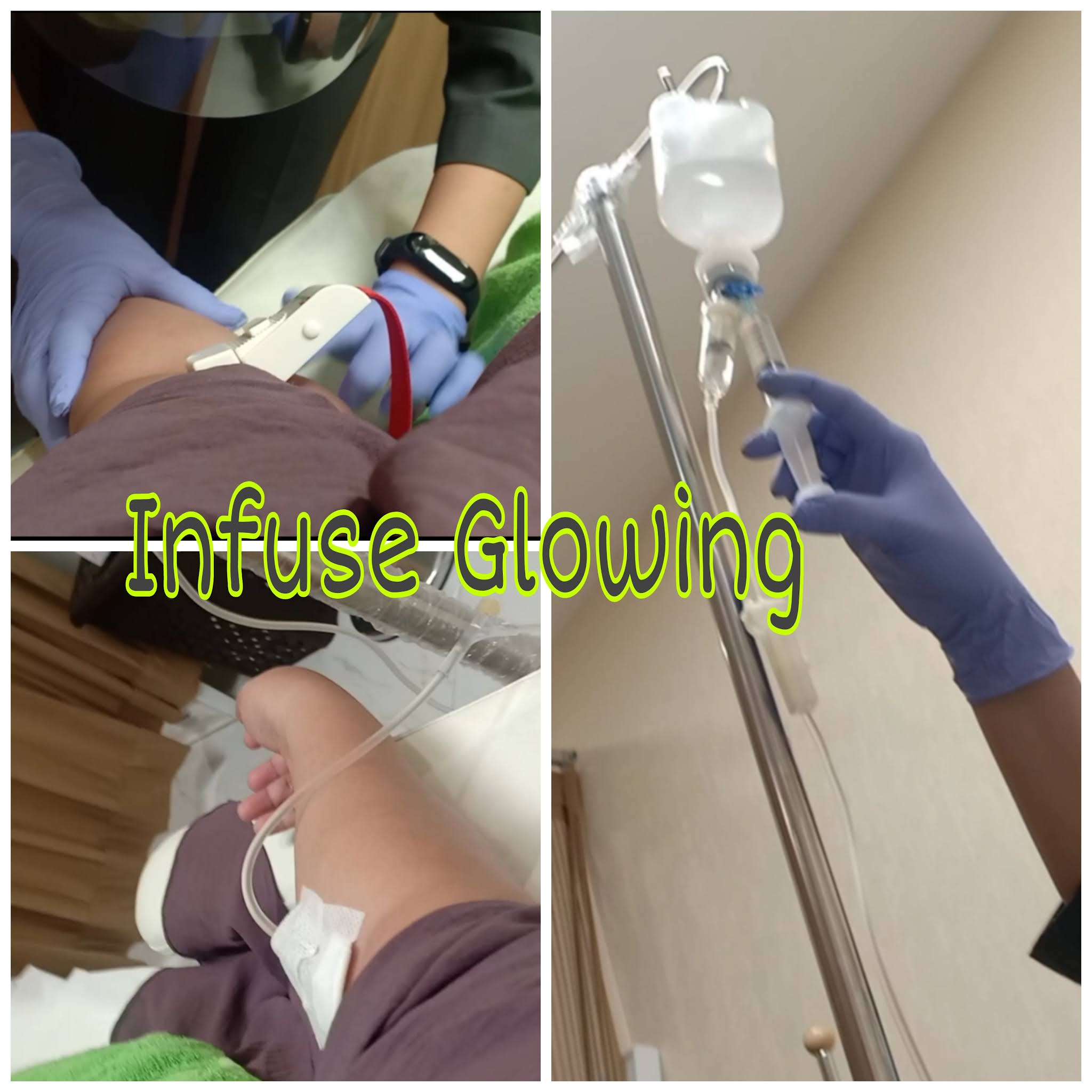 Flek Blocker Treatment ZAP Clinic Ampuh Cegah Flek Hitam Usia 40 Tahun