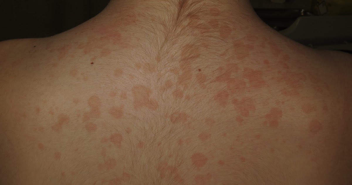 Dermapixel: Manchas que no pican