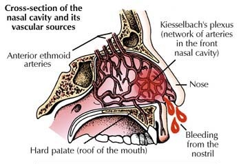 Facts for U: Your NOSE bleeds at Higher Altitudes - WHY??