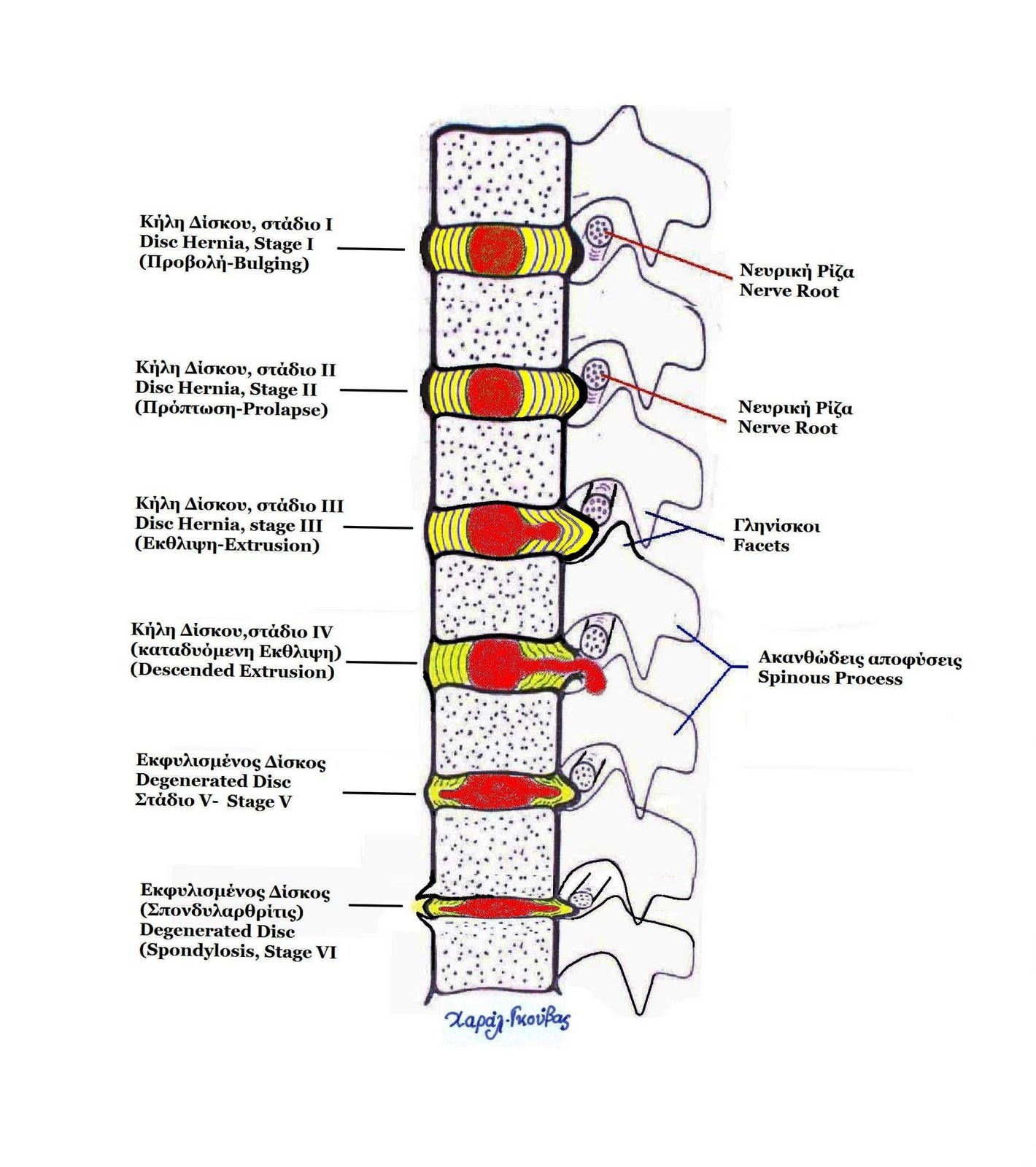 ΤΙ ΕΙΝΑΙ ΟΣΦΥΑΛΓΙΑ