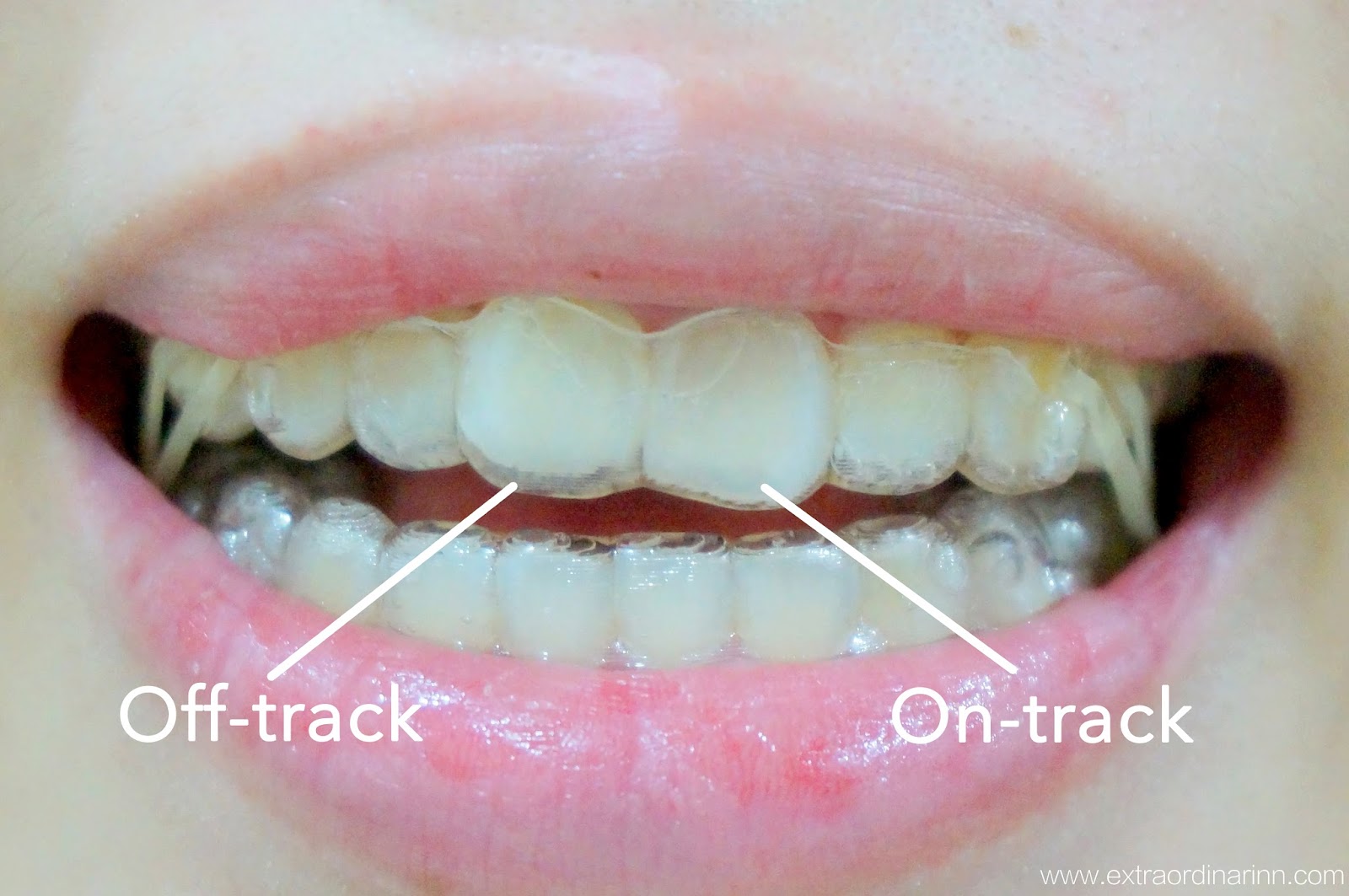 Carinn; carerynn | Malaysia Fashion, Beauty & Lifestyle Blog: Carinn x ...