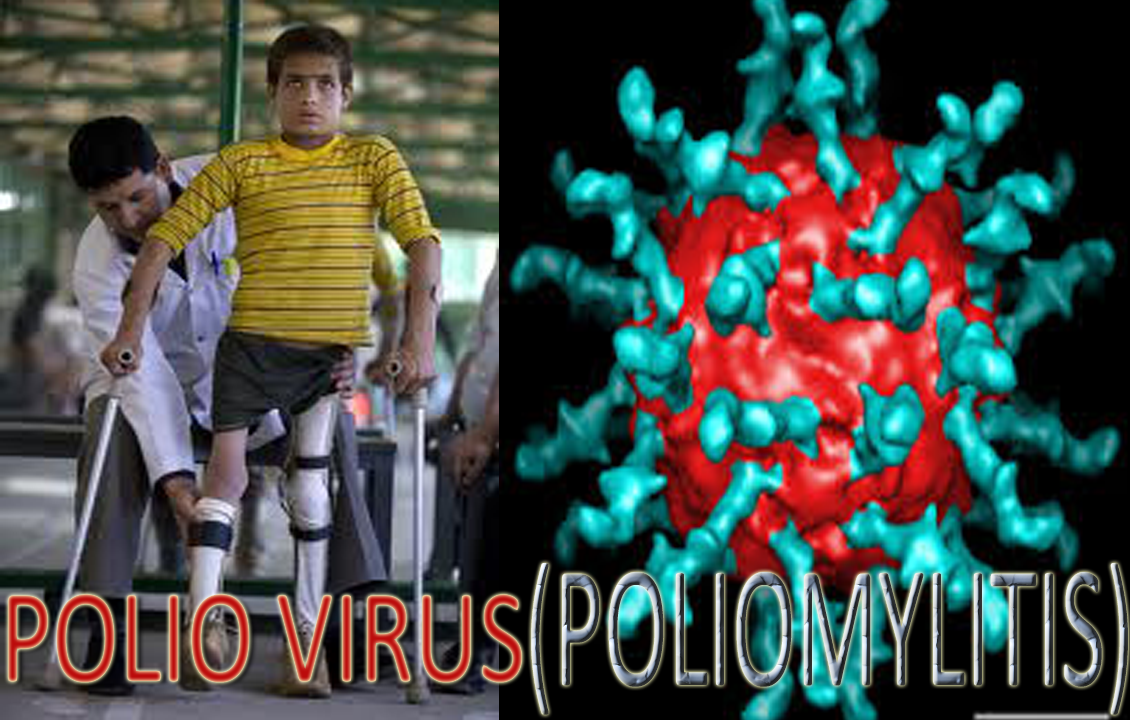 POLIOMYLITIS/ POLIO-INFECTIOUS DISEASE | MEDICAL TODAY