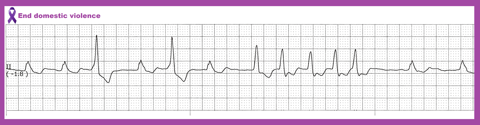 Practice EKG Strips 358