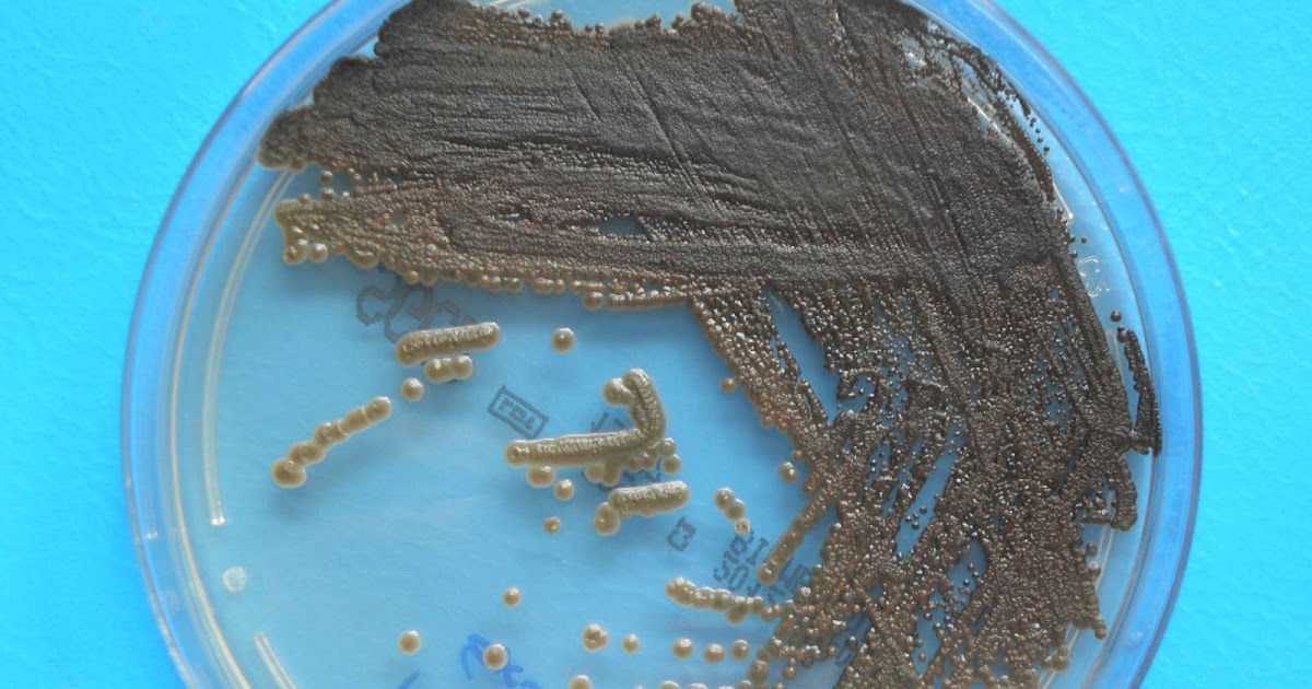 ATLAS MICOLOGIA: EXOPHIALA DERMATITIDIS