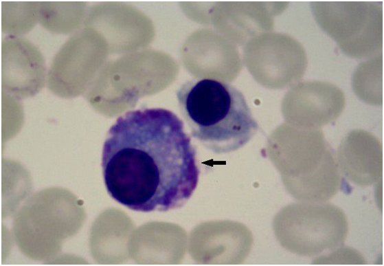 Hematologia Clínica : Atlas de Hematologia