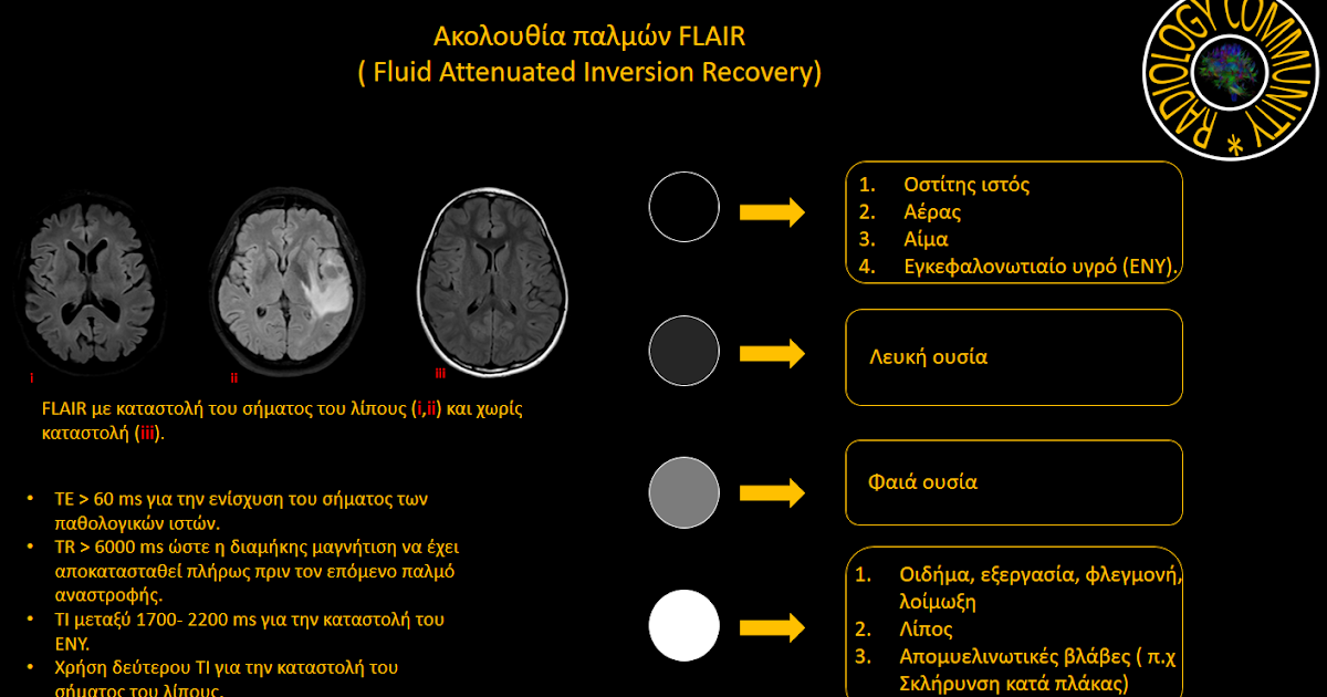 Radiology Community: Ακολουθία παλμών FLAIR