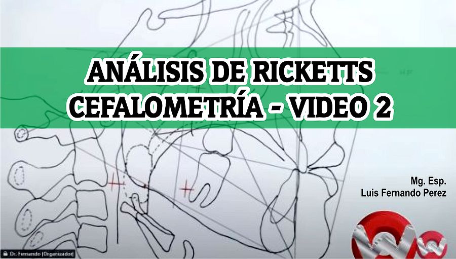 CEFALOMETRÍA: Análisis de Ricketts - Video 2