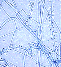 Microbiología y Epidemiología: Trichophyton rubrum. Trichophyton ...