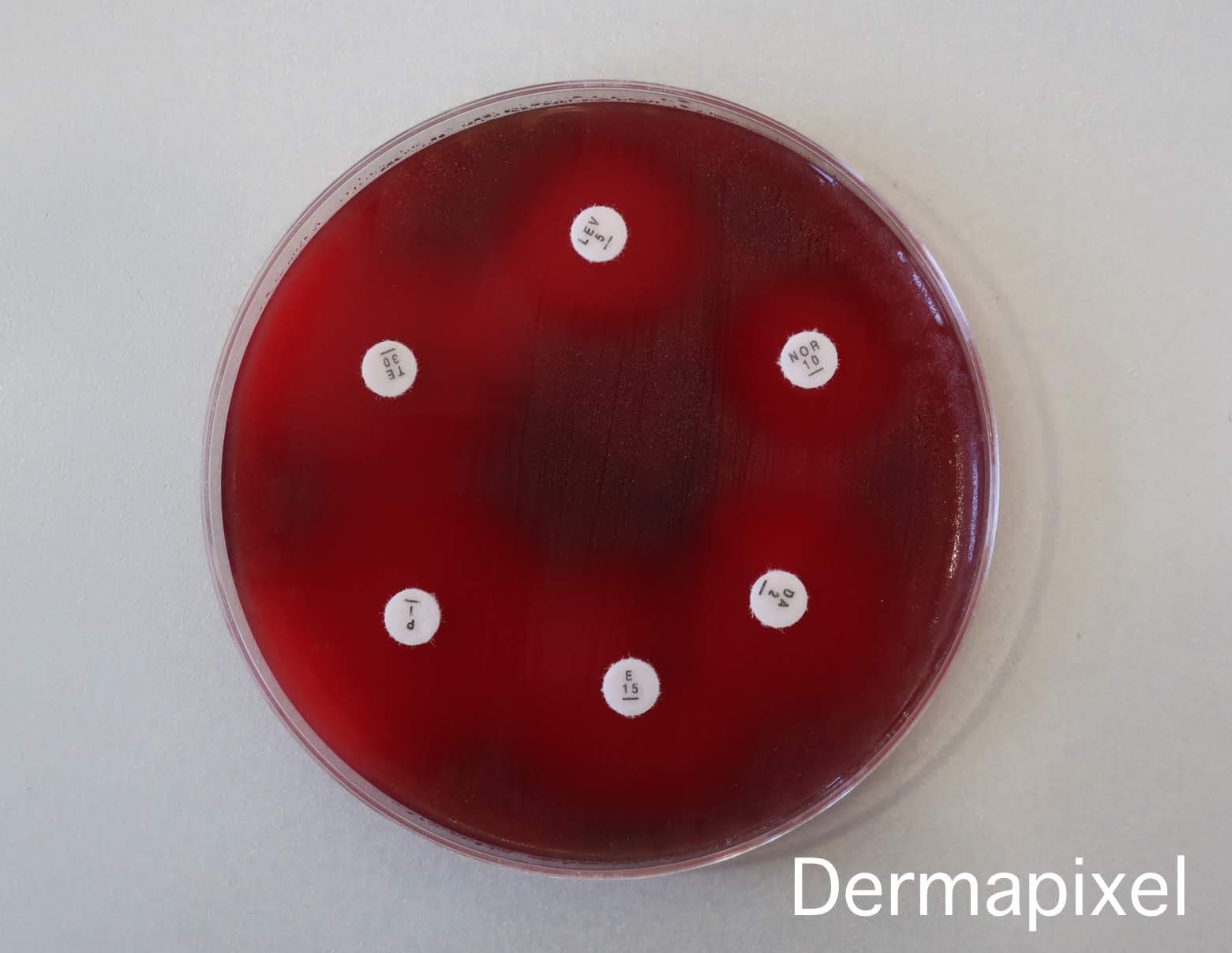 Dermapixel: junio 2019