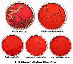 Agar EMB | Anecdotas del Laboratorio