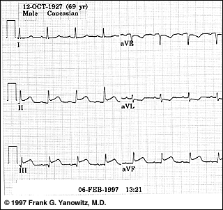 ER goldbook: EKG interpretation