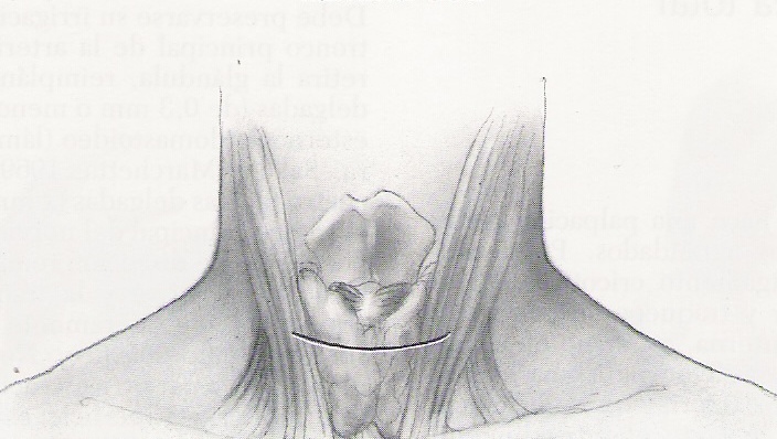 Tu Cirugía General: Tiroides