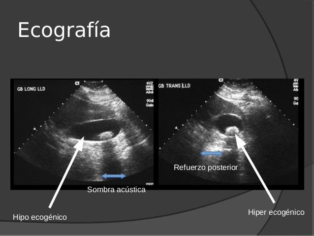 IMAGEN PARA EL DIAGNÓSTICO Y MEDICINA NUCLEAR. Uribarri-Salamanca ...