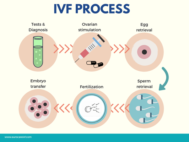 Steps Involved in the IVF Process