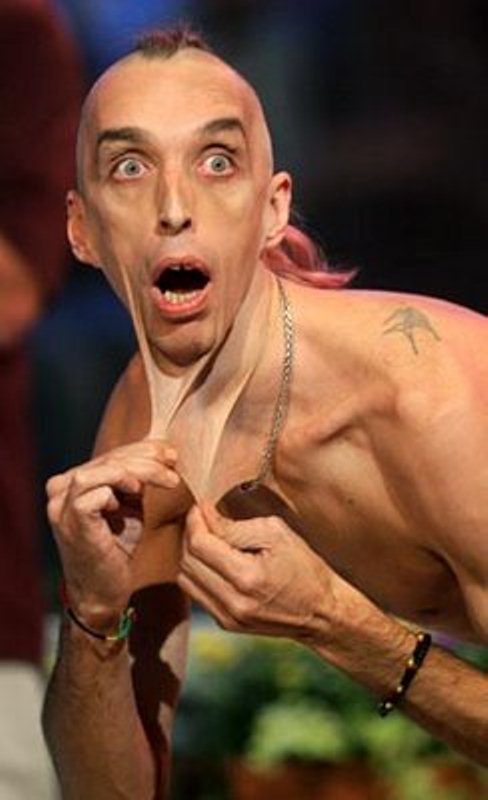 Lagak Ngeri Garry Turner Meregangkan Kulitnya | Blog Buruk