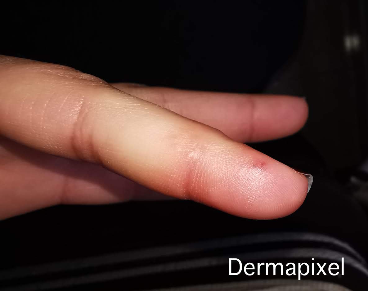 Dermapixel: abril 2020