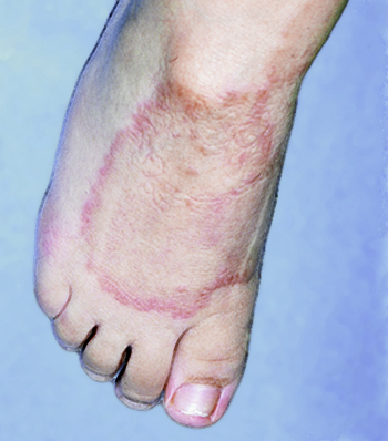 EL RINCÓN DE LA MEDICINA INTERNA. juanpedromacaluso@yahoo.com.ar ...