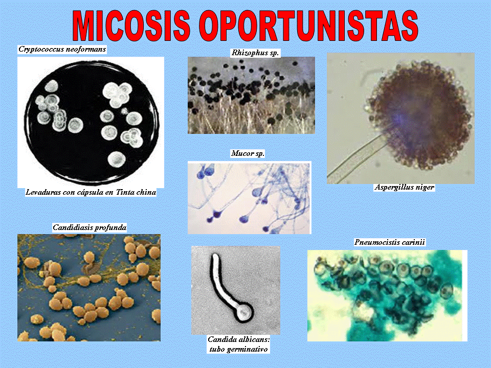 M810: MICOSIS