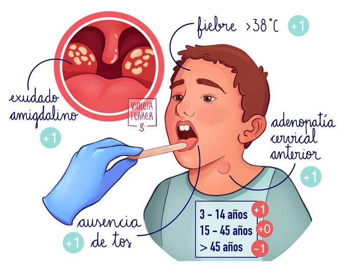ZONA DE SALUD DE OFRA: CRITERIOS DE CENTOR para faringoamigdalitis ...