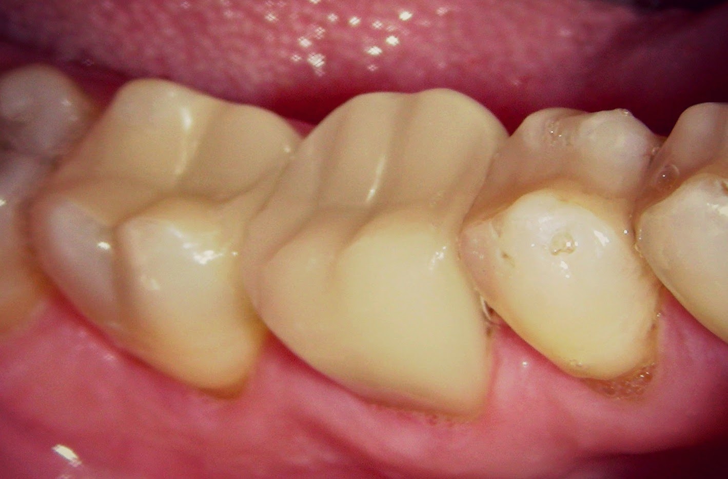 #Tubuleslive Event: CEREC Integration in Practice - TOOTH GERM