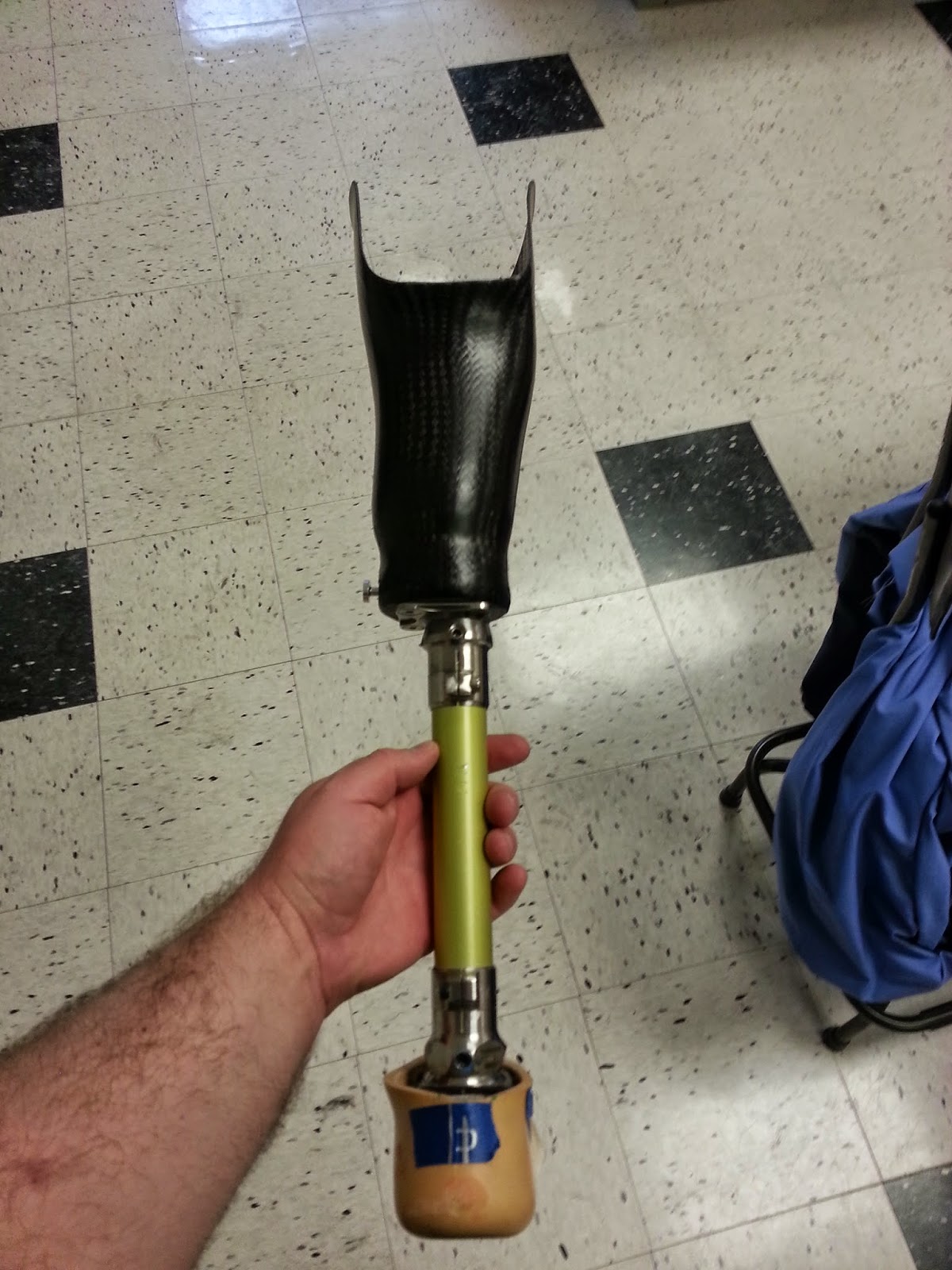 Prosthetic Projects: Locking liner Carbon Fiber transtibial ...