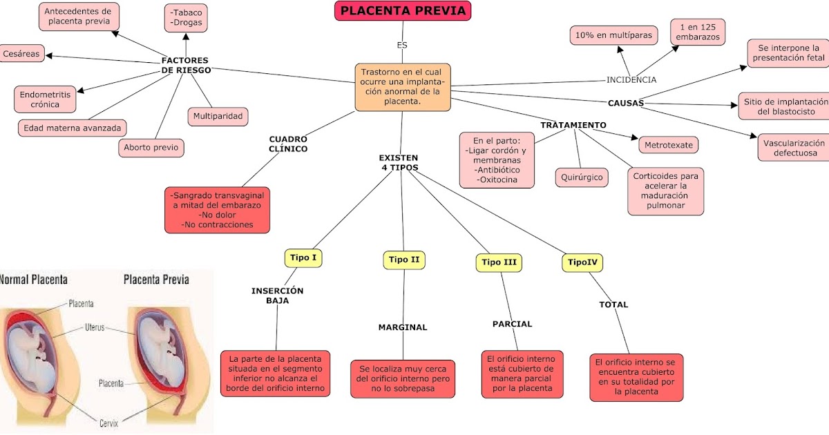Ginecología y Obstetricia 2016 por Carmen Elena Chavez G. : Placenta ...