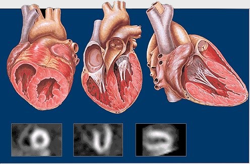 Protocolos de medicina nuclear: CARDIOLOGIA NUCLEAR