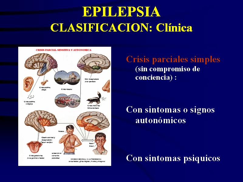 folha8: Epilépticos precisam de apoio do governo
