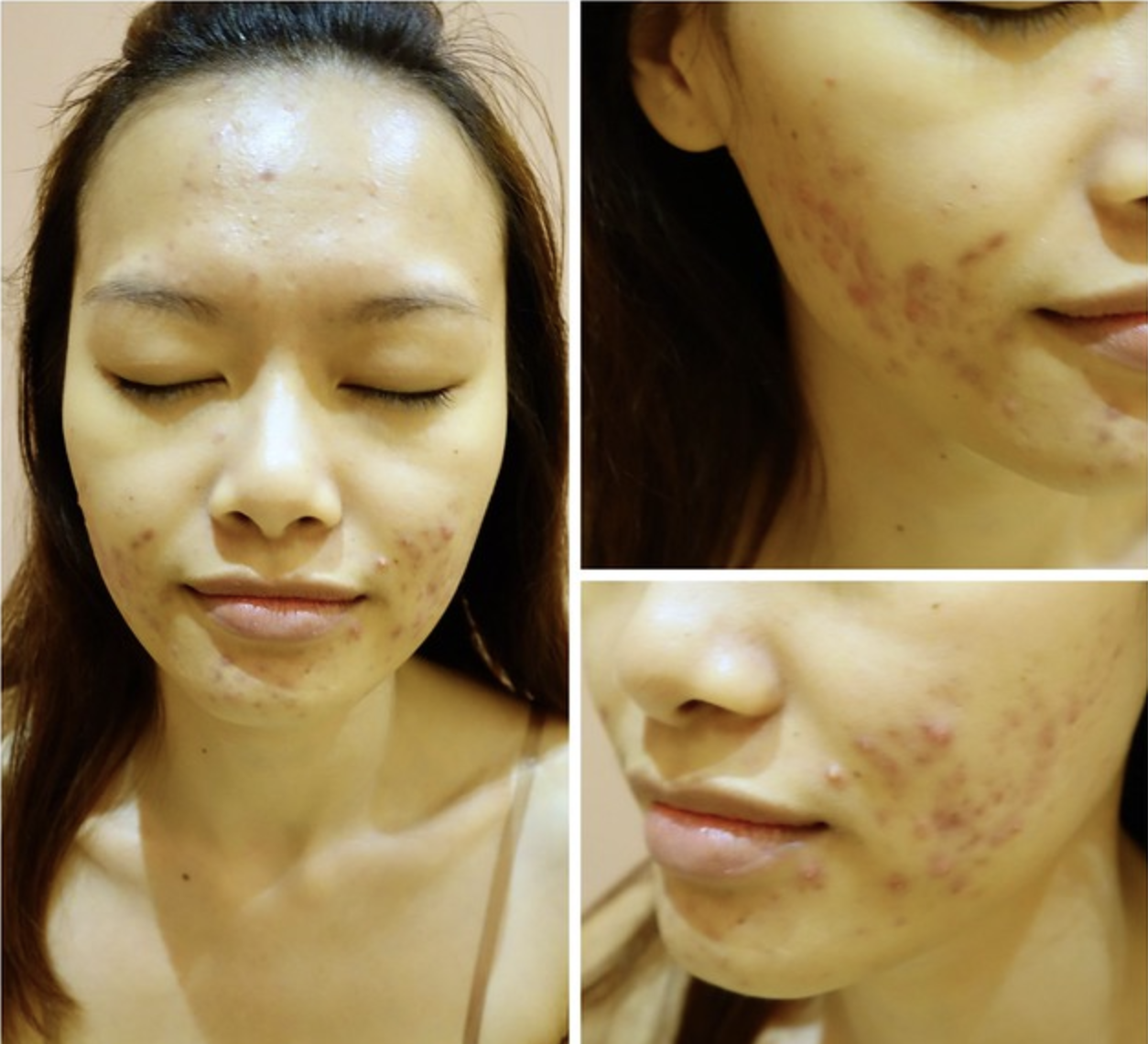 My Skincare Routine with Cetaphil - carolinemayling